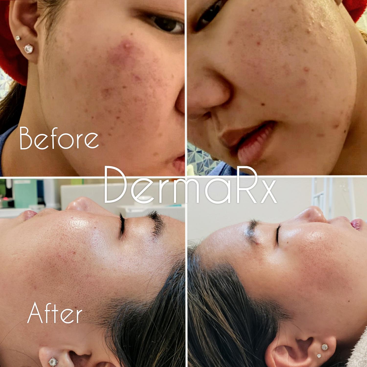 Get Personal Revitalizing Skincare at DermaRx – Daily Sundial